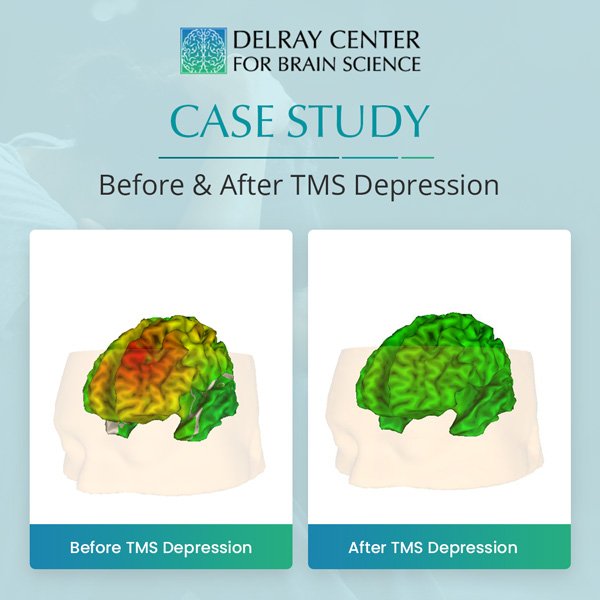 Research Aims and Current Projects – Nate Shanok, PhD
